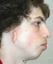 Little Baby Face Foundation | Facial Birth Deformity Corrections