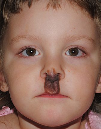 Mission – Little Baby Face